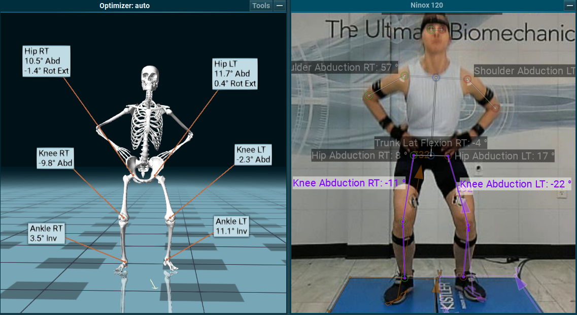 2D vs 3D: Unterschiede und Limitationen verstehen - Velamed Medizintechnik